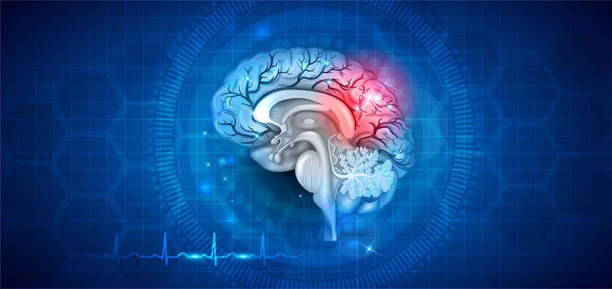 8 Effective Ways to Prevent Stroke | Aster Medcity Kochi Blog | Aster Hospitals